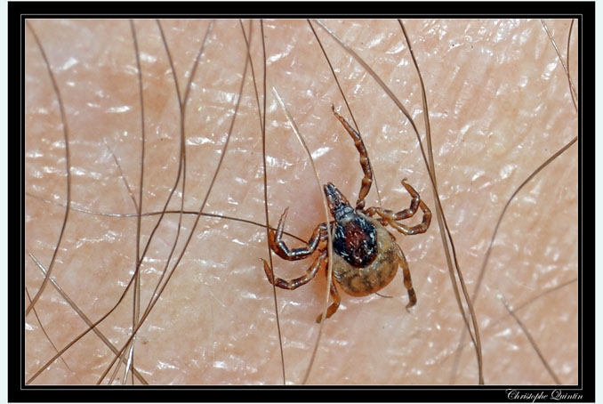 Maladie ou borréliose de Lyme | Agence régionale de santé Bourgogne ...